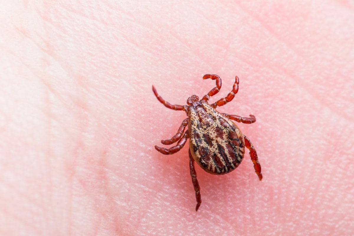 How To Safely Remove Ticks from Humans and Pets, According to Experts ...